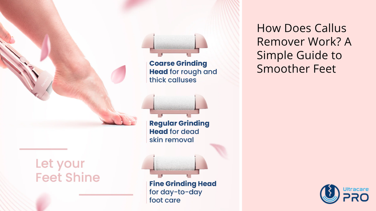 How Does Callus Remover Work? Discover the Secret to Soft Feet – UltraCare PRO