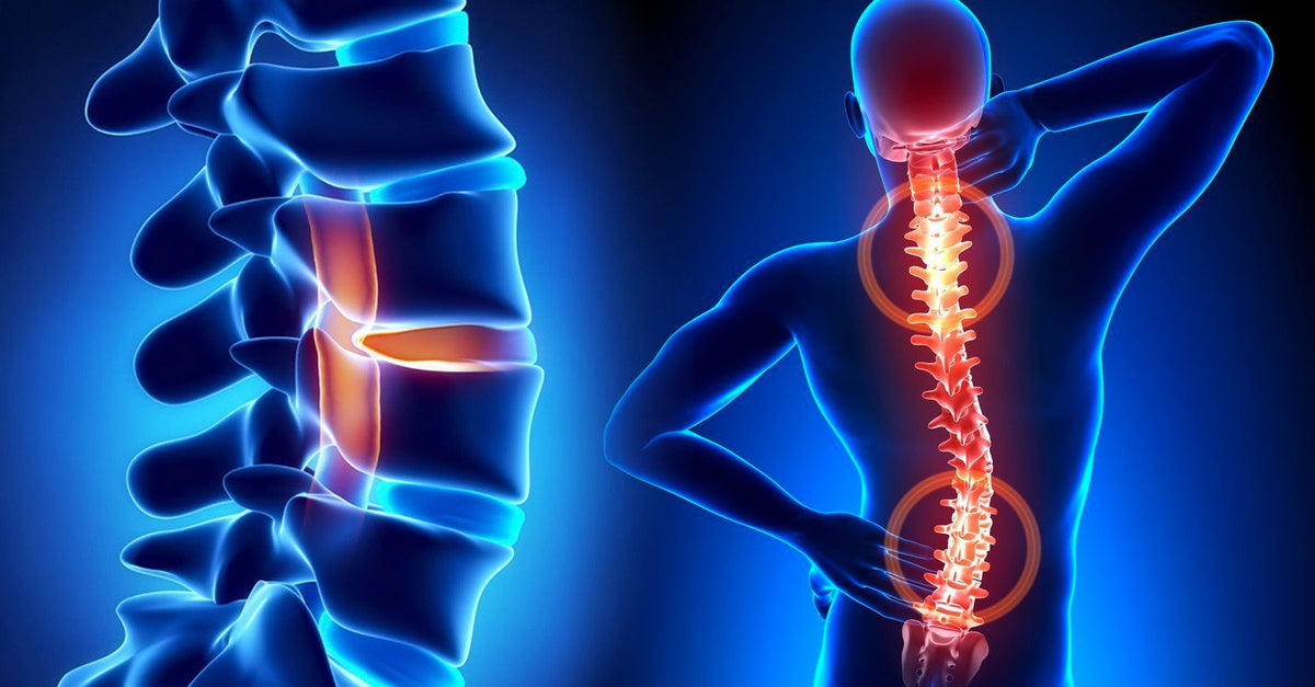 Spine Balancing Exercises to Ease Back Pain – UltraCare PRO