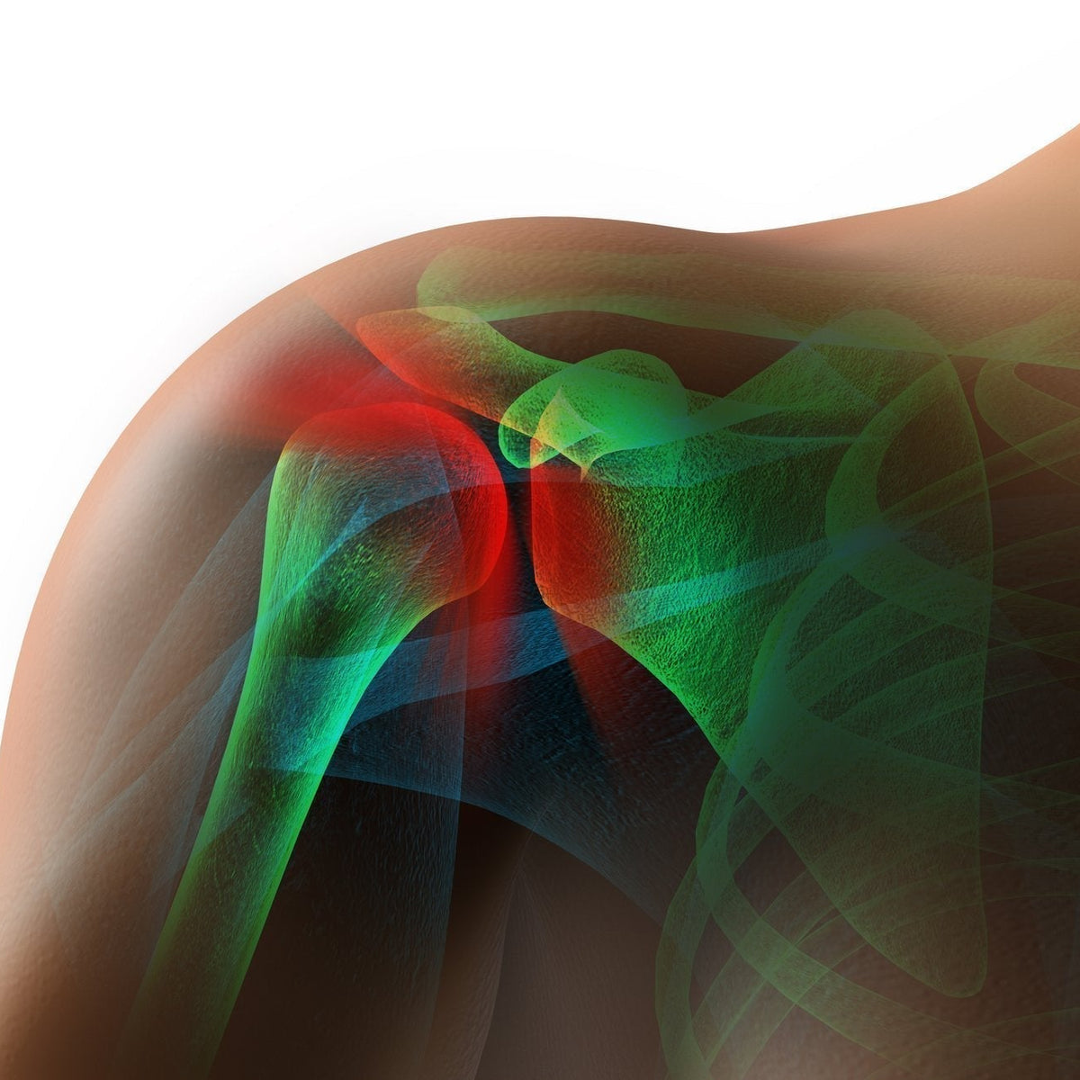 Shoulder Pain: Causes, Treatments & Diagnosis - Healthy Shoulder ...