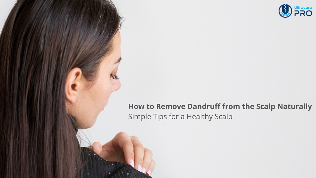 How to Remove Dandruff from Scalp Naturally for Clear, Healthy Hair ...