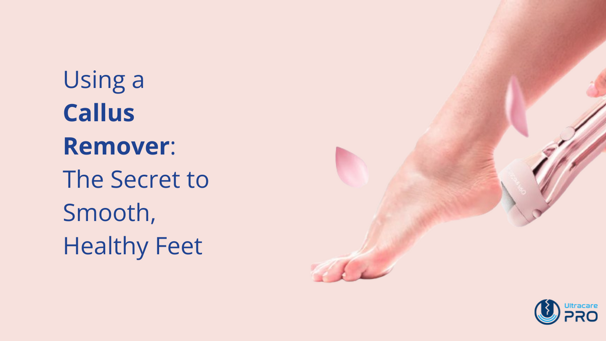 Using a Callus Remover for Smooth, Healthy Feet – UltraCare PRO