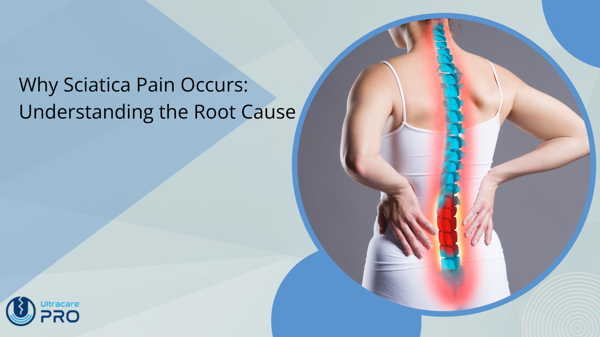 Why Sciatica Pain Occurs: Causes & Long-Term Relief – UltraCare PRO